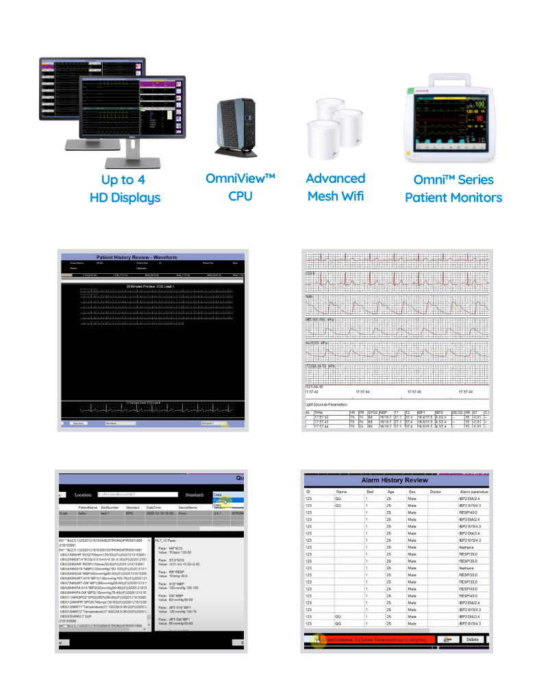Patient Monitors | Infinium Medical